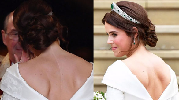 Princess Eugenie shares her 'scar and encourage' as she marks ...